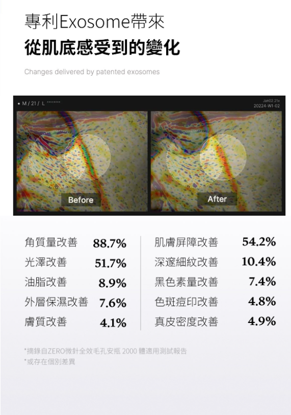 Medicube | ZERO微針全效毛孔安瓶 2,000ppm 30毫升 - 平行進口 - EXP: 2027.01 - 2000ppm - | HKTVmall 香港最大網購平台