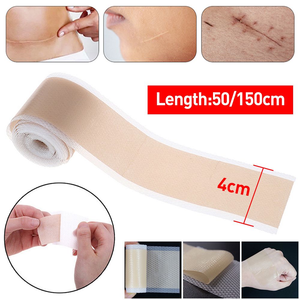 ALPHASTAR SUPERMALL | 4 x 50cm Scar Removal Silicone Gel Tape Efficient ...