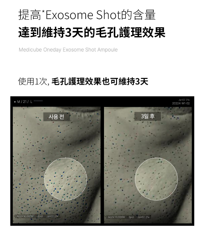 Medicube | ZERO微針全效毛孔安瓶 7,500ppm 30毫升 - 平行進口 - EXP: 2027 - 7500ppm - | HKTVmall 香港最大網購平台