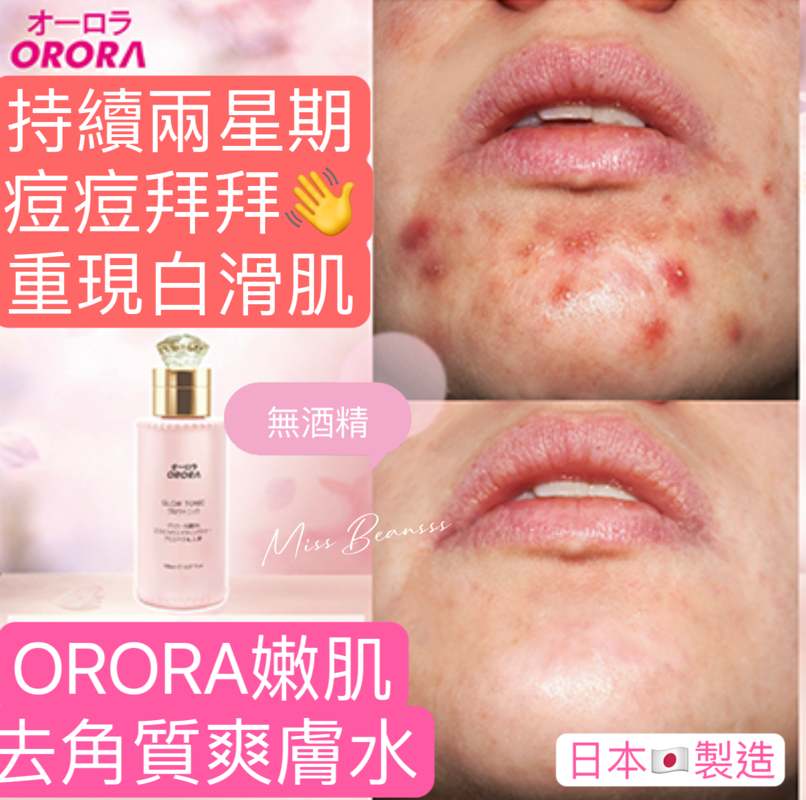 ORORA | 日本Orora嫩肌去角質爽膚水 150ml (日本製) | HKTVmall 香港最大網購平台