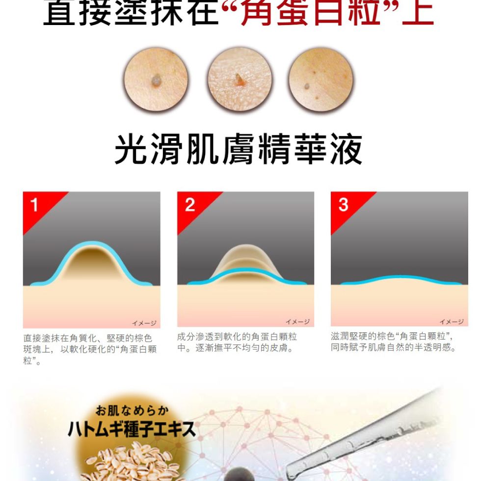 BRAIN COSMOS | Ipocare Ex 除疣專用美容液 18ml (原裝行貨 6111) | HKTVmall 香港最大網購平台