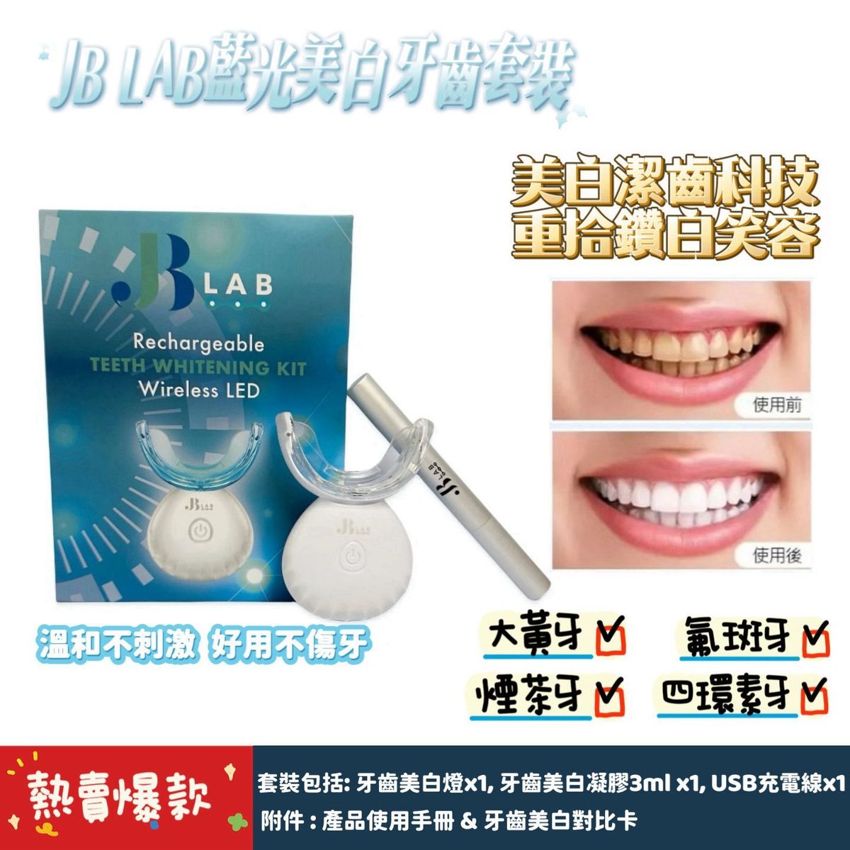 JB LAB | JB LAB 藍光美白牙齒套裝 (包含一支美白凝膠筆) | HKTVmall 香港最大網購平台