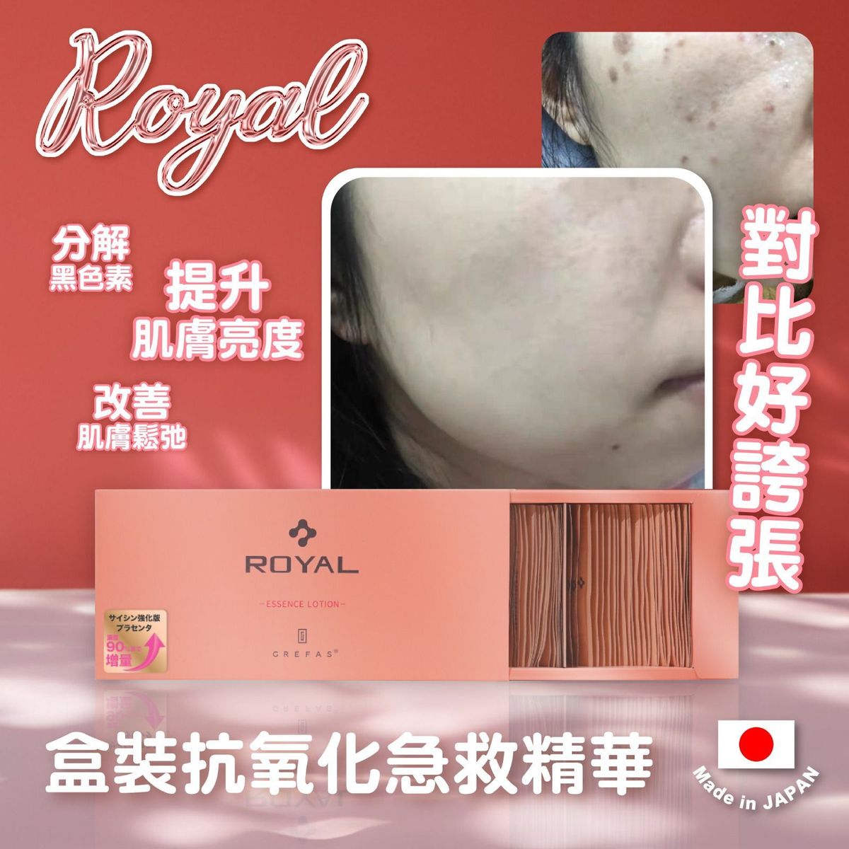 Royal | 最新版 GREFAS Royal 盒裝臍帶血引導精華加強版 90小包 | HKTVmall 香港最大網購平台