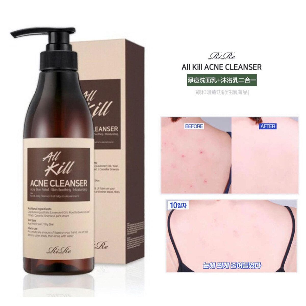 Rire | All Kill 淨痘洗面乳+沐浴露二合一 500ml (平行進口） | HKTVmall 香港最大網購平台